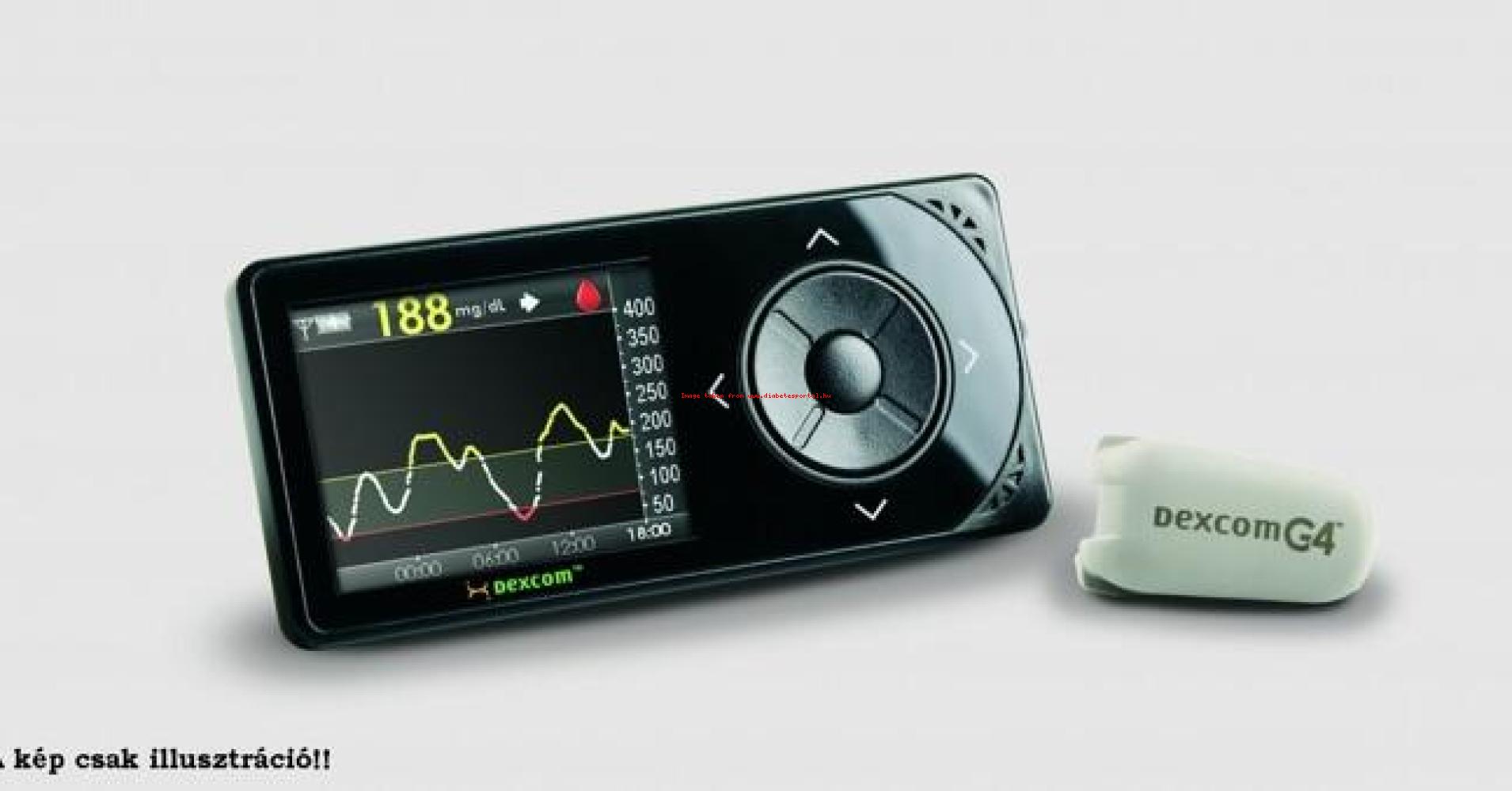 Elveszett Dexcom G4 típusú vevőegység keresi tulajdonosát!